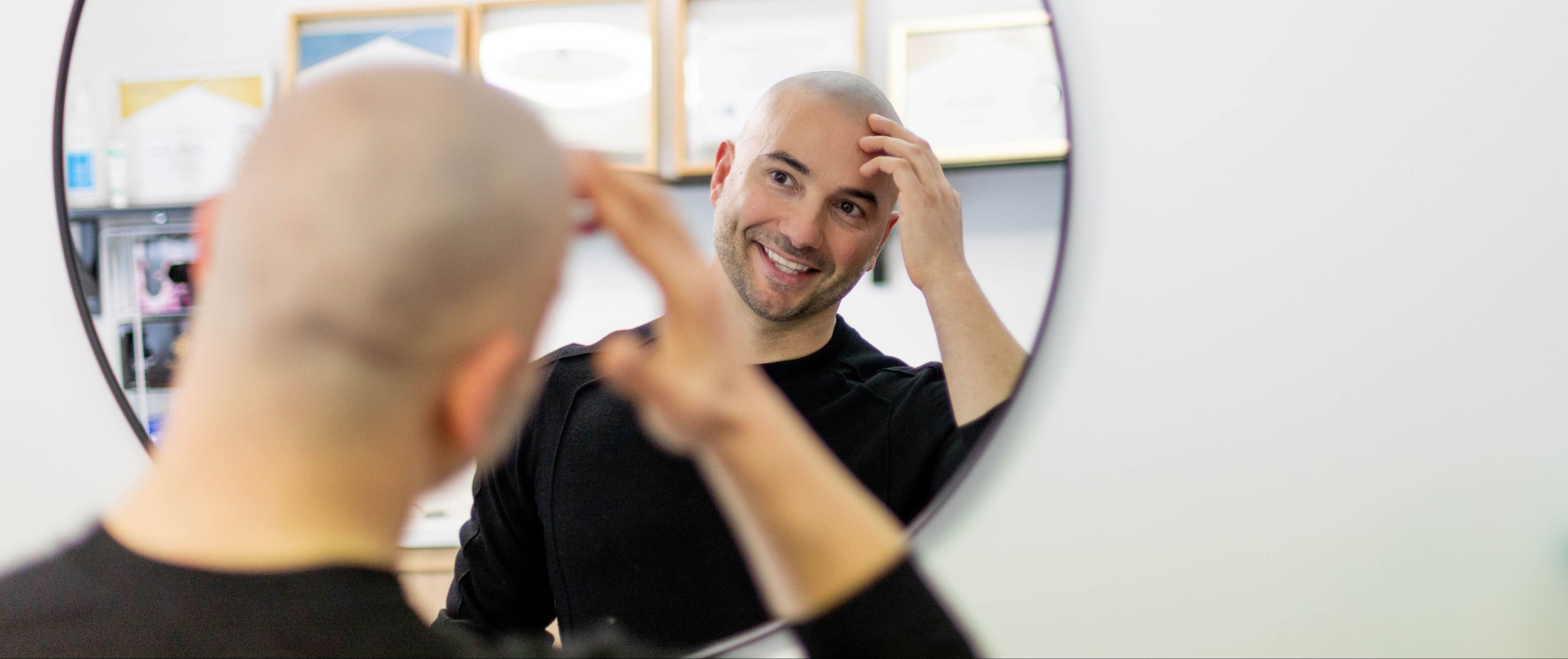 Why Is My Scalp So Shiny? How to Reduce Bald Head Shine | Zero Shine ...